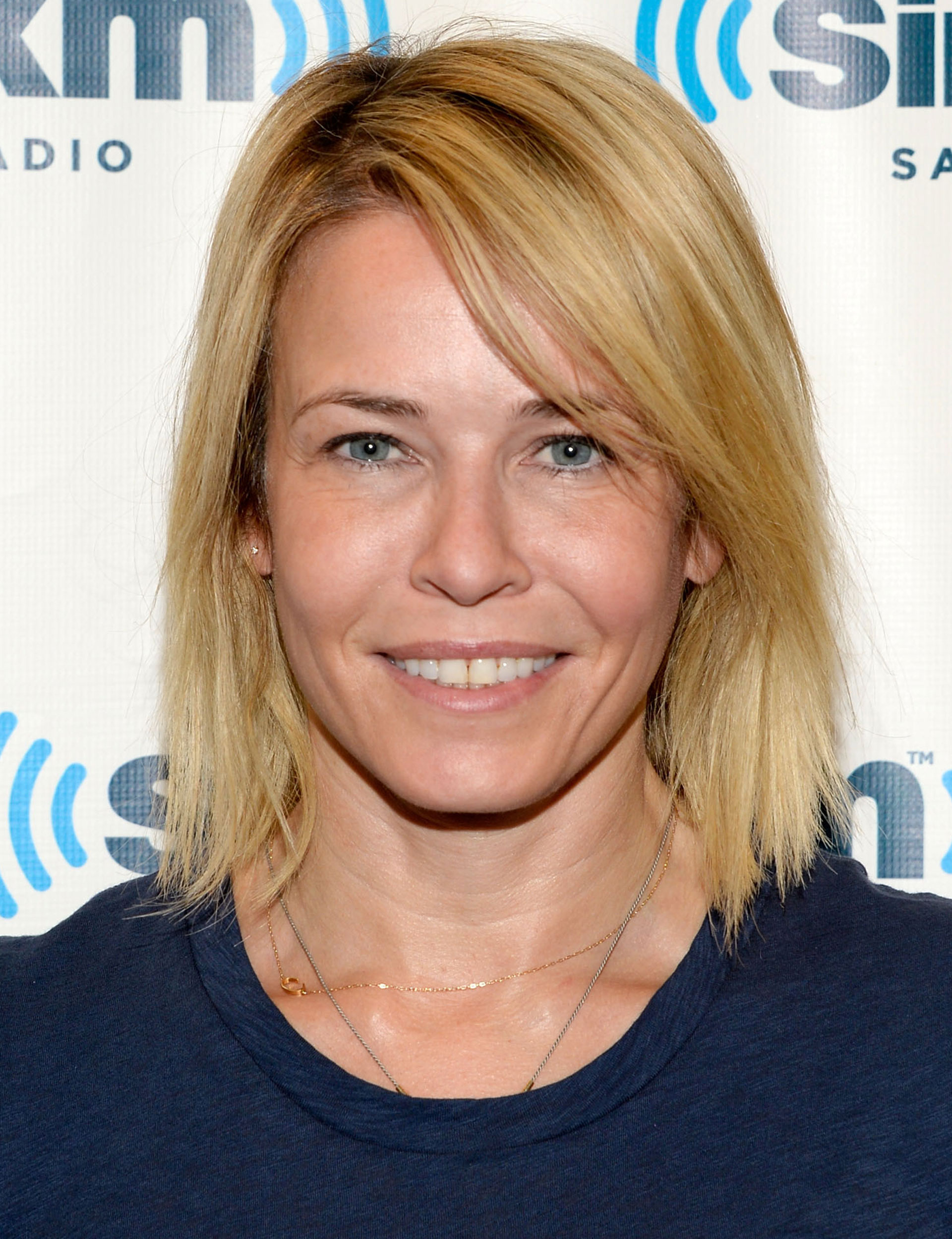 Chelsea Handler Hair Loss